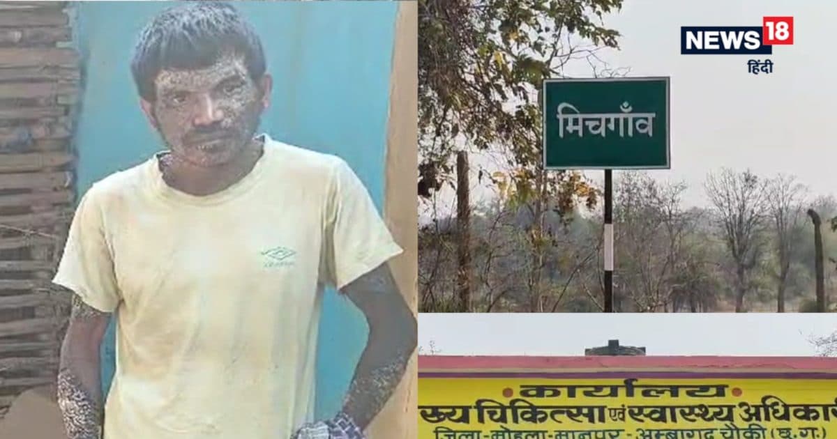 Bizarre Disease: 35 साल का शख्स, पेड़ की छाल में बदल रहा शरीर, खौफ खाते ...