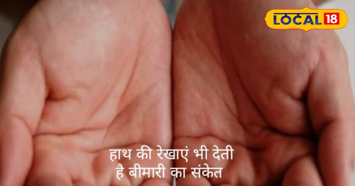 The lines on the hand give signs of disease, this is how you can ...