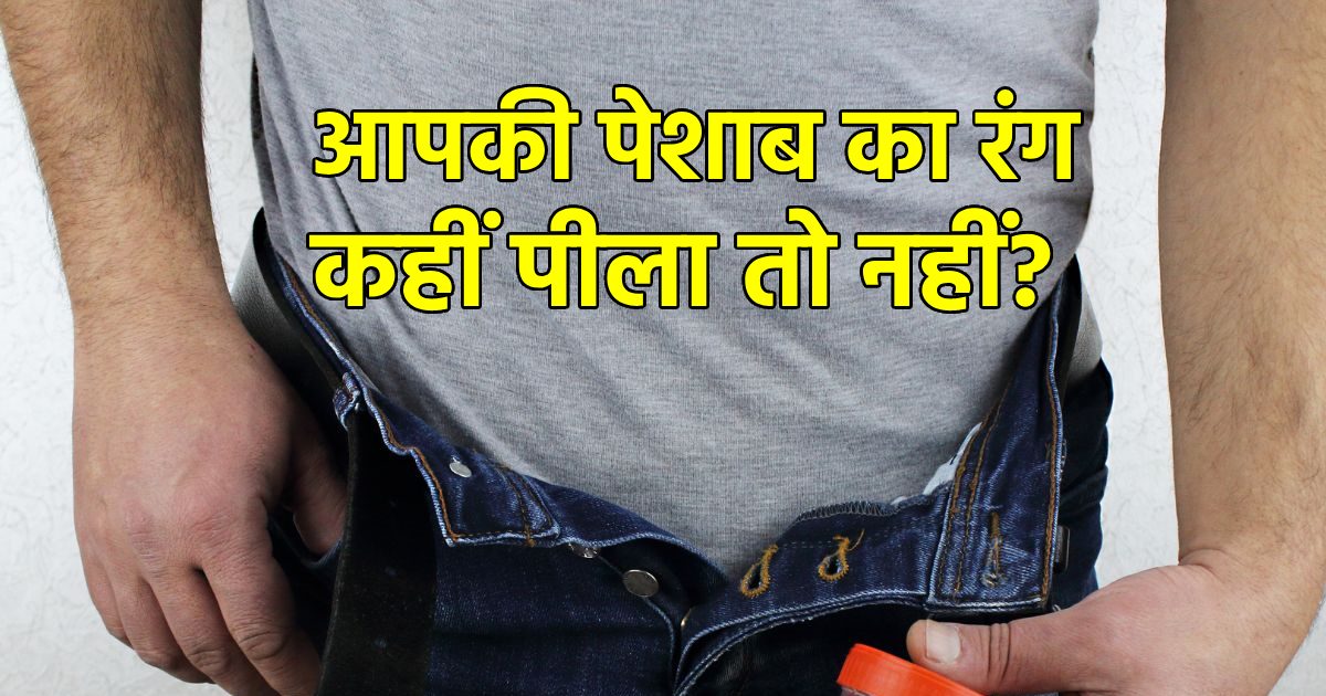 गर्मियों में किस वजह से पेशाब हो जाती है पीली? कैसे पाएं इस परेशानी से ...