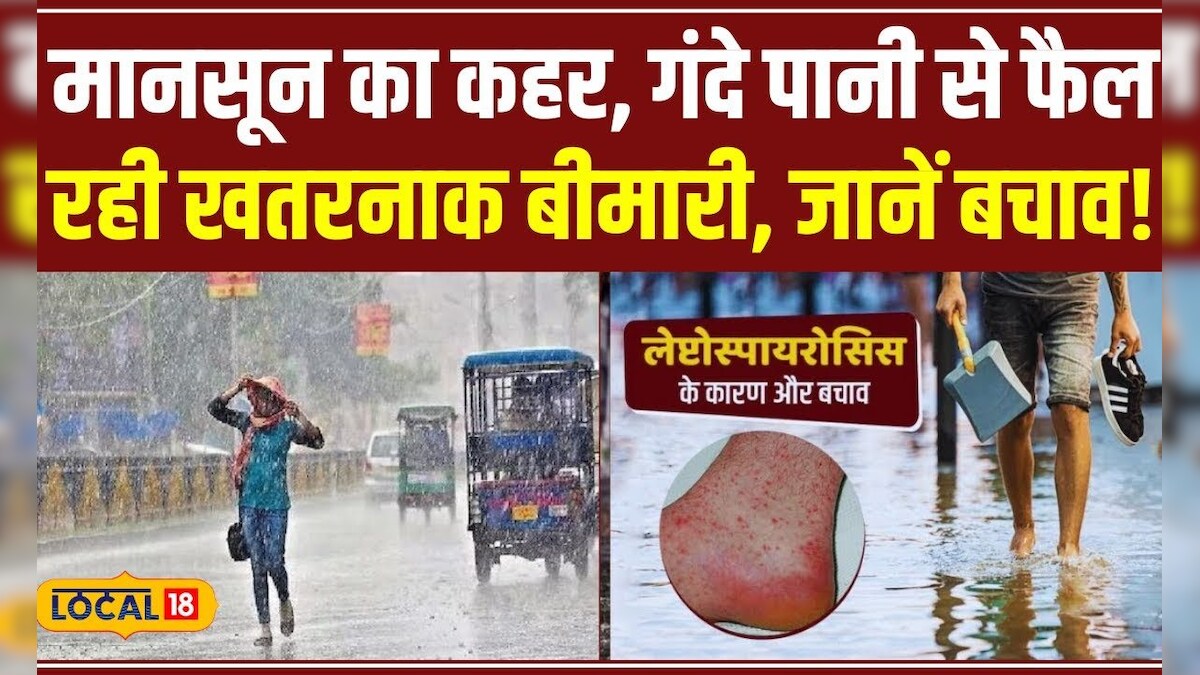 Mansoon 2024: बारिश में सावधान! जानें Leptospirosis क्या है और इससे कैसे बचें? #local18 – News18 ...