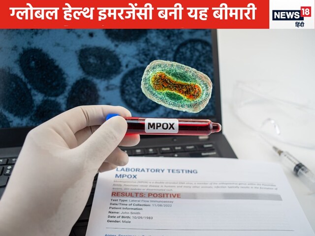 Mpox PCR Kits: भारत ने खुद बना लिया मंकीपॉक्स की जांच की RT-PCR किट, 40 ...