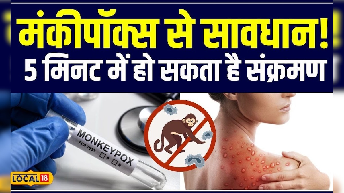 Monkey Pox का तेजी से फैलता खतरा, जानें पूरी सच्चाई! | Causes ...