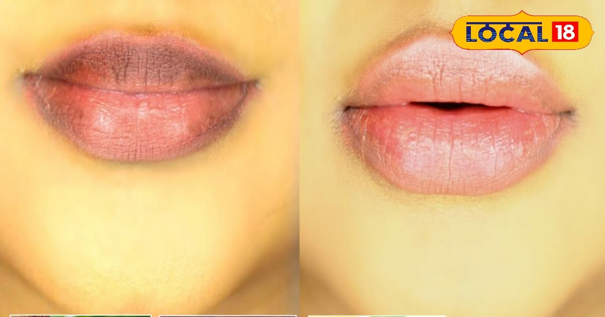 Caution! Sudden darkening of lips is a sign of illness, expert tells a ...