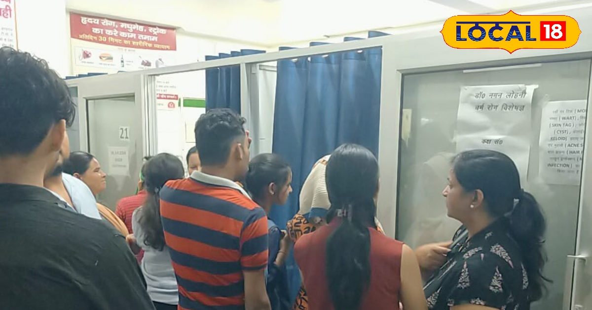 Almora News: अल्मोड़ा के सरकारी अस्पताल में सस्ता हुआ इलाज, देखें रेट लिस्ट - News18 हिंदी