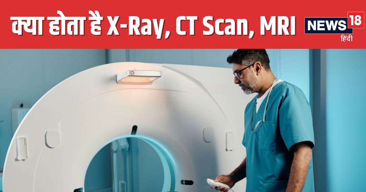 X-Ray, CT Scan और MRI में क्या अंतर है? किन कंडीशन में किए जाते हैं ये स्कैन, यहां जानें काम की ...