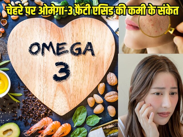 Signs of deficiency of omega-3 fatty acids on skin: त्वचा पर ओमेगा-3 ...