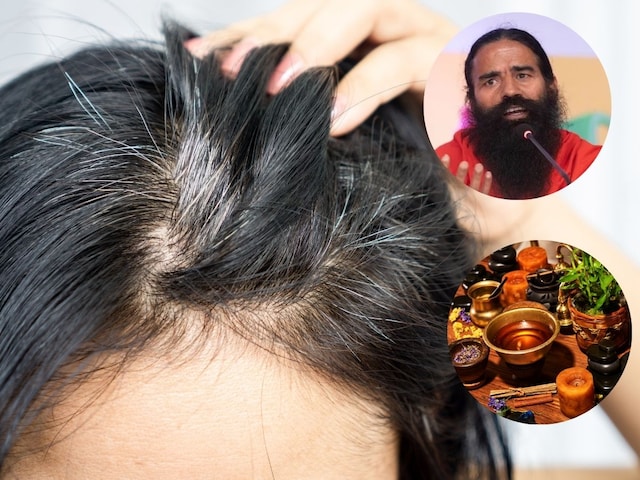 Baba Ramdev Black hair tips: बालों को प्राकृतिक रूप से काला बनाने के ...