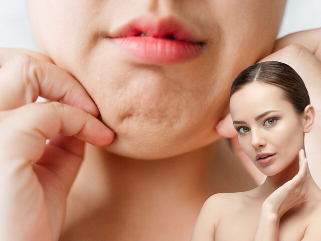 Tips To Remove Face Puffiness: सुबह चेहरे की सूजन कम करने के 5 आसान ...