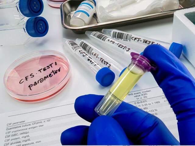 ब्रेन के लिए कितना जरूरी है सेरेब्रोस्पाइनल फ्लुइड? एक दिन में कितना बनता CSF, डॉक्टर से जानें ...