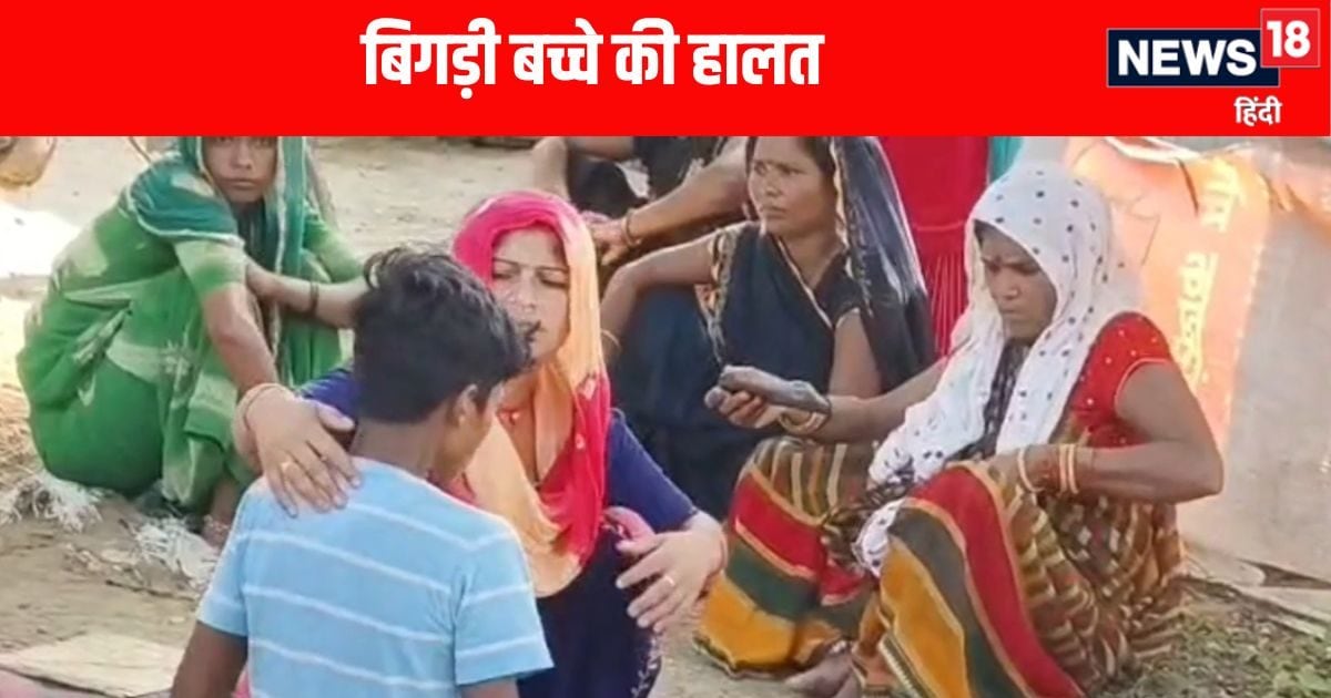 Rewa News: बच्चा करने लगा डॉग जैसी हरकतें, रेबीज इंजेक्शन भी नहीं आया ...