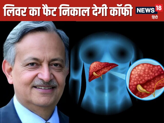 Black Coffee Can Reduce Liver Fat Dr SK Sarin Tips | ब्लैक कॉफी पीने से ...