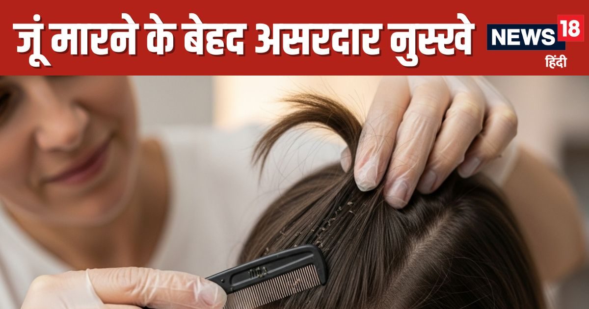 5 Home Remedies To Remove Head Lice Instantly | सिर की जूं हटाने के 5 ...