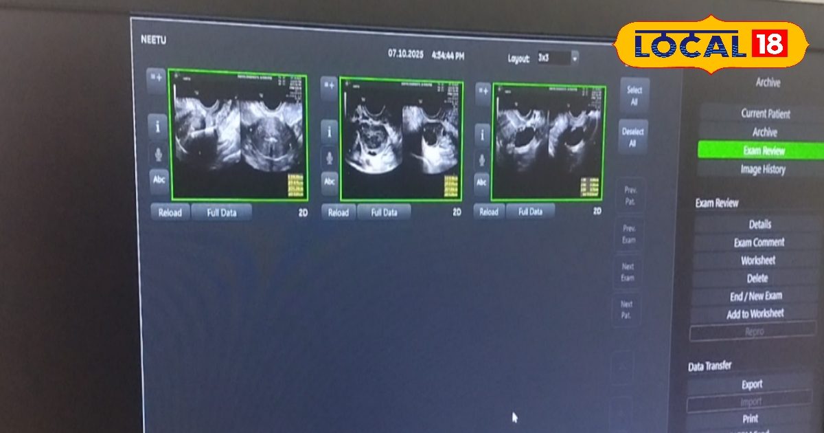 How to safe Ultrasound scan for pregnancy women and uterus baby ...