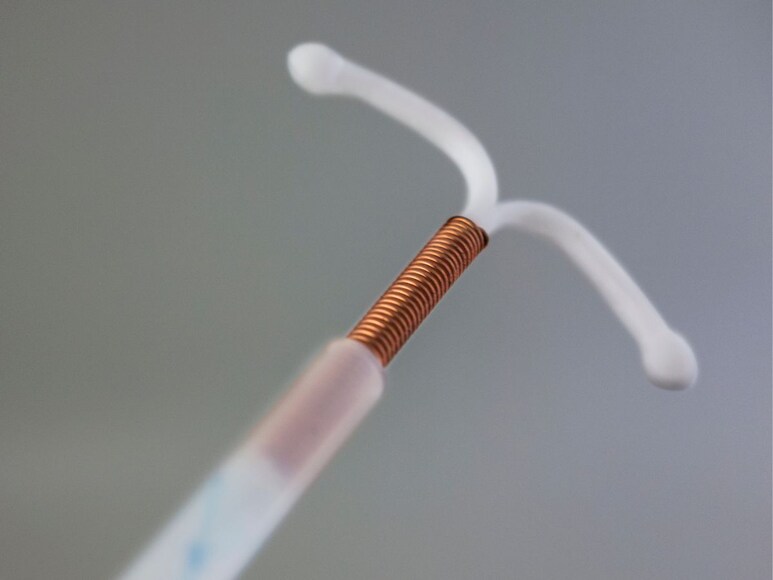 Viral baby born holding copper t contraceptive iud her mother used to ...
