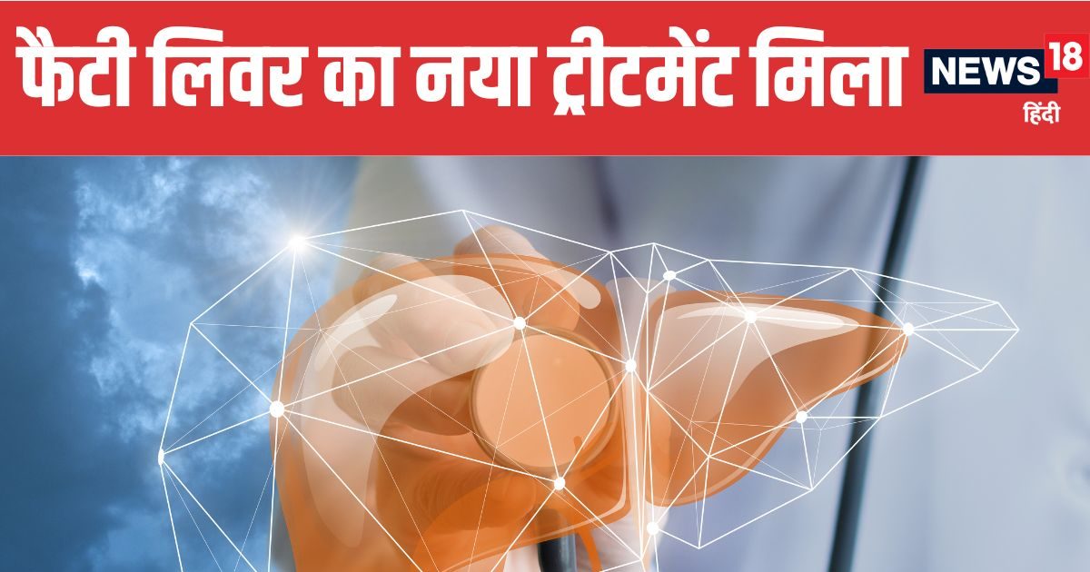 Existing Drugs Show Promise in Reversing Fatty Liver Disease Study ...