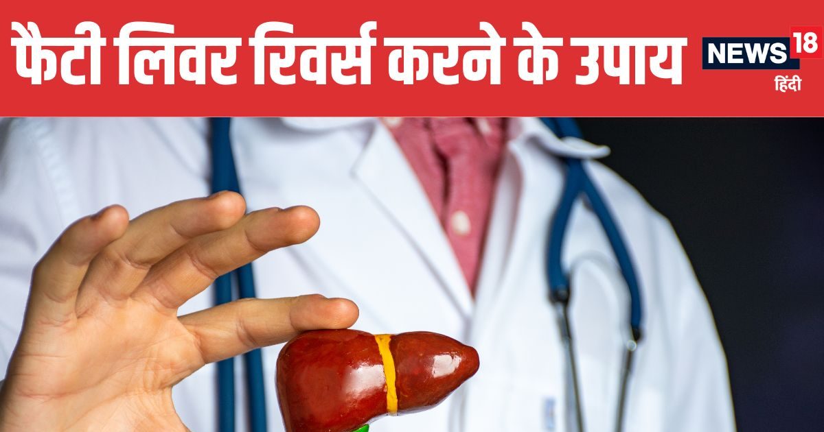 5 Doctor Tips to Cure Fatty Liver Naturally | फैटी लिवर से छुटकारा पाने ...