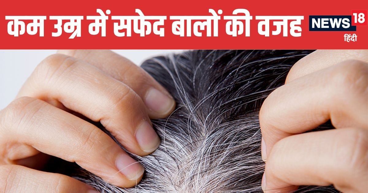 Vitamin Deficiency and White Hair Causes and Foods to Prevent | किस ...