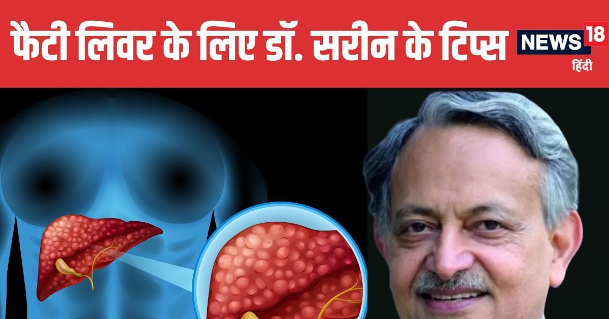 Black Coffee for Fatty Liver Dr SK Sarin Tips | फैटी लिवर में ब्लैक ...
