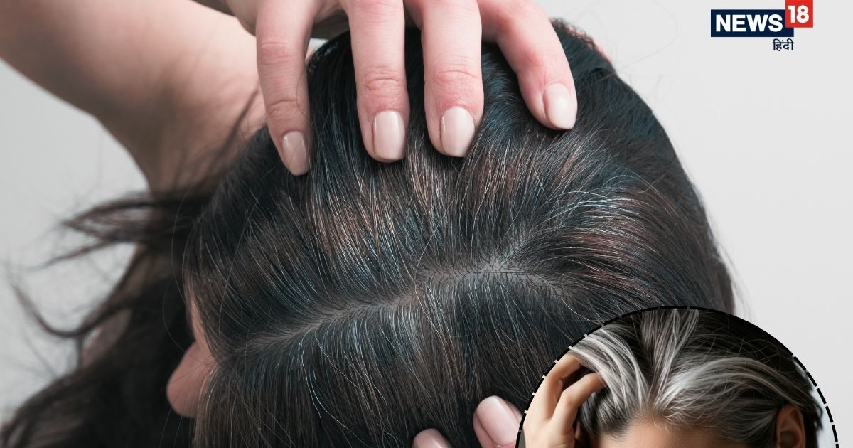 Why Some People Get Grey Hair Early : क्यों कुछ लोगों के बाल जल्दी सफेद ...