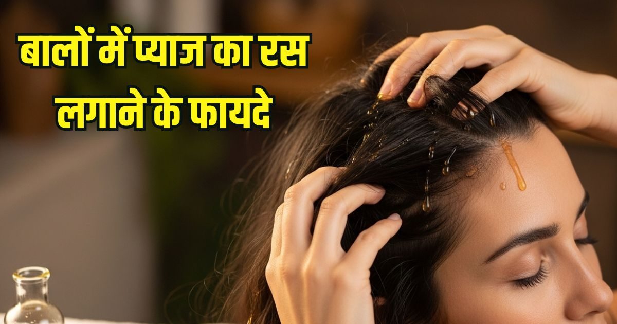 Balo me pyaj ka ras lagane ke fayde: झड़ते बालों पर लगेगा फुल स्टॉप, इस ...