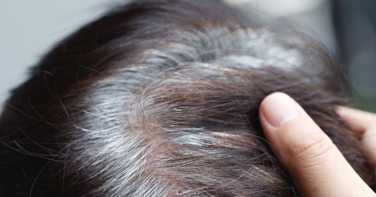 How to stop grey hair problem: बाल सफेद क्यों होते हैं, इन्हें वाइट ...
