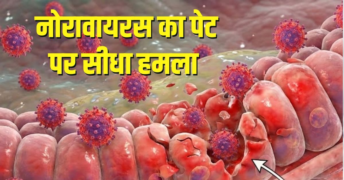 Norovirus Alert | Winter vomiting bugs | norovirus-symptoms-intestine ...
