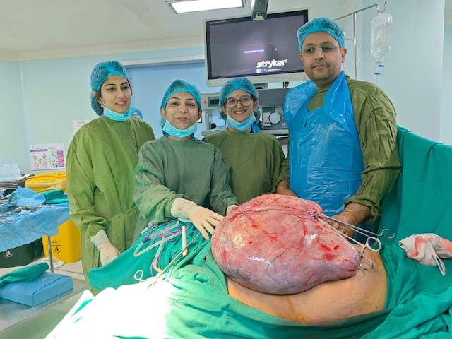 Cloudnine Hospital Doctors Remove16 Kg Giant Uterine Fibroid Preserves ...