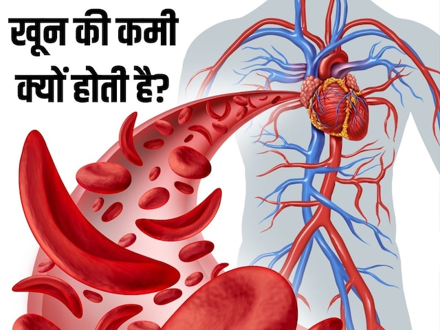 Causes of Anemia in Men Doctor Reveals Symptoms and Prevention Tips ...