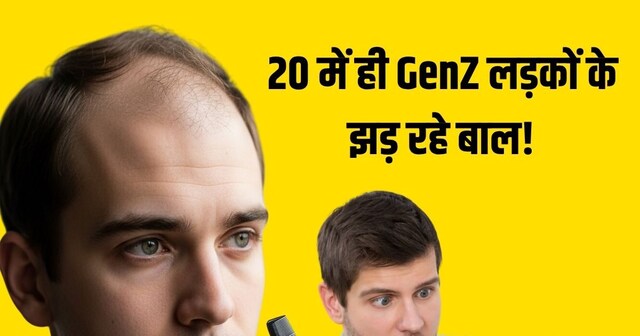 Beauty Tips: 20 साल के होते ही Gen Z लड़कों के झडने लगे हैं बाल, तो 40 ...