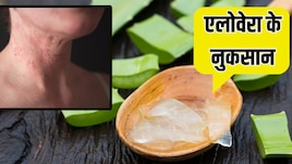 Skin Tips: किन लोगों को एलोवेरा नहीं लगाना चाहिए? नेचुरल रेमिडी से भी ...