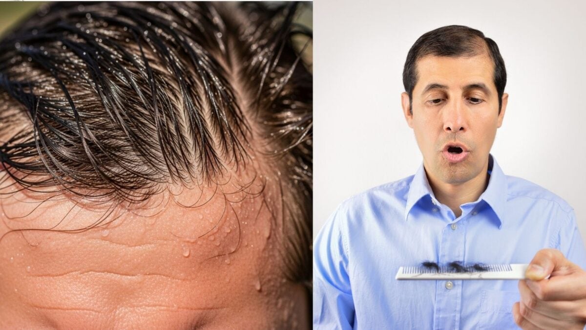 Hair Tips: पसीने से चिपचिपा स्कैल्प बन सकता है हेयर फॉल का कारण, अपनाएं ...