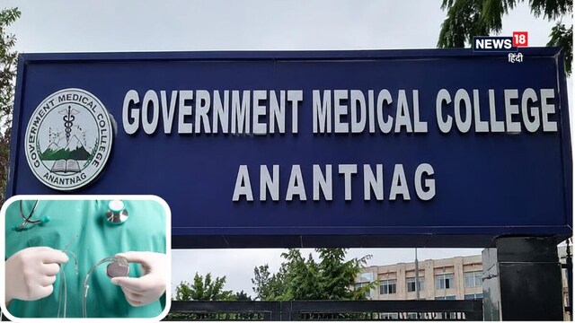 Jammu Kashmir Pacemaker Scam: 27 लोगों का ठीक था दिल, तब भी लगा दिया ...