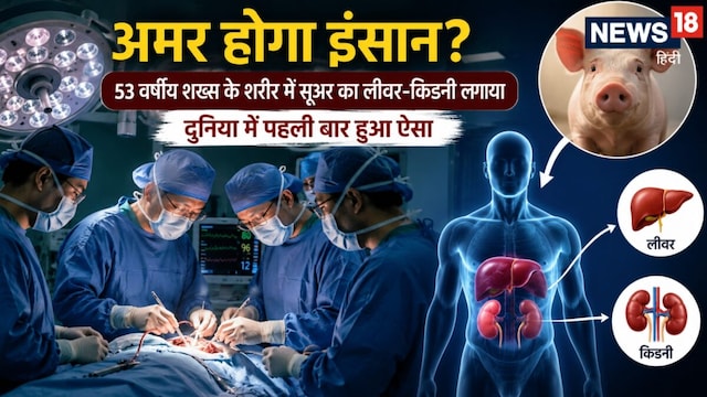 अमर होगा इंसान? 53 वर्षीय शख्स के शरीर में सूअर का लीवर-किडनी, पहली बार ...