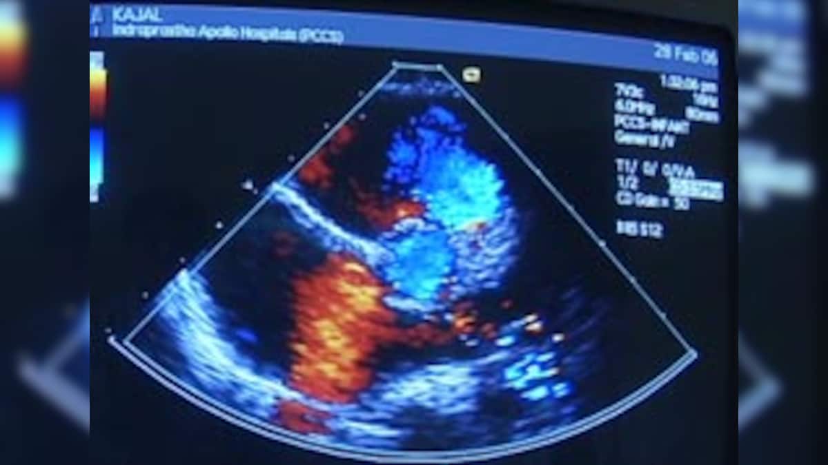 Heart disease reversed in noble trial