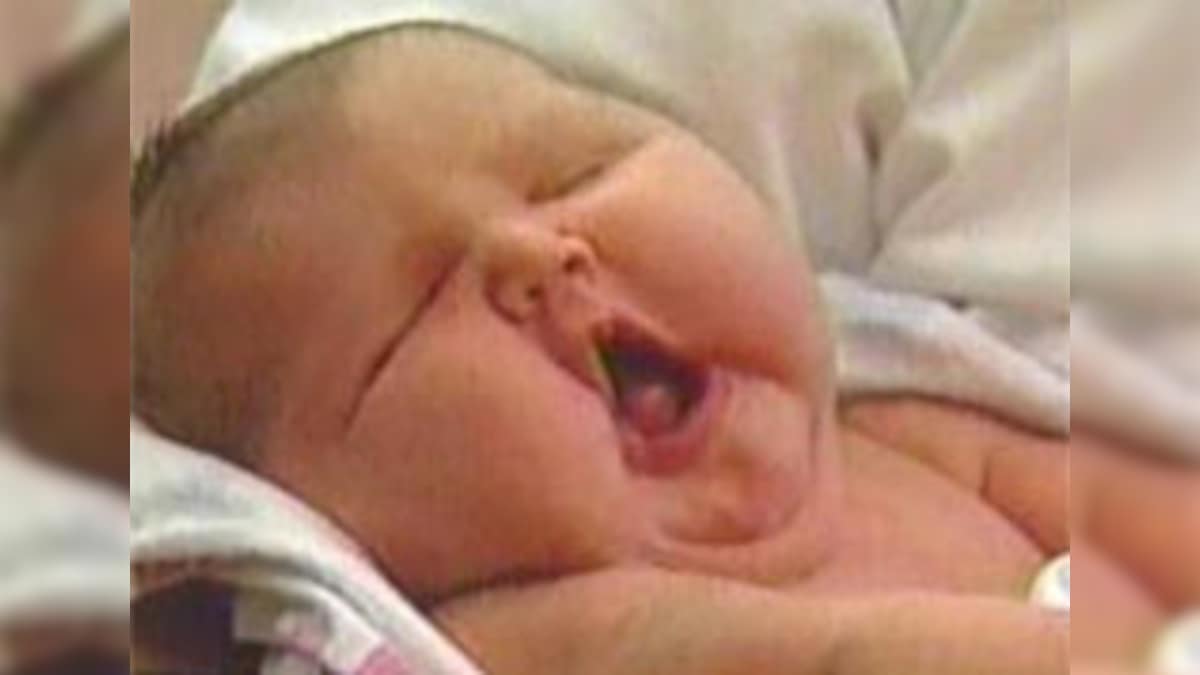 China’s heaviest baby weighs over 6 kg - News18