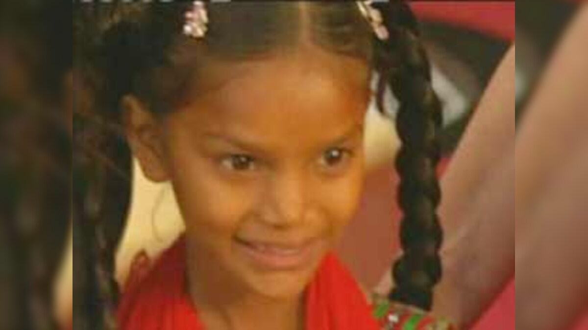 Pinki's story raises awarness about cleft lipped kids - News18