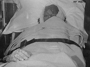 Video of Jackson's hair on fire surfaces after 25 years