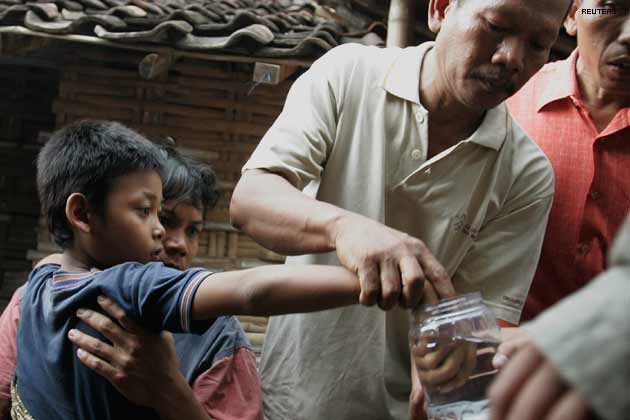 15 weirdest medical cures in the world - News18