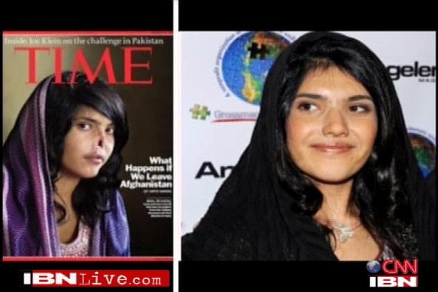 Afghan girl whose nose was cut off gets new face - News18