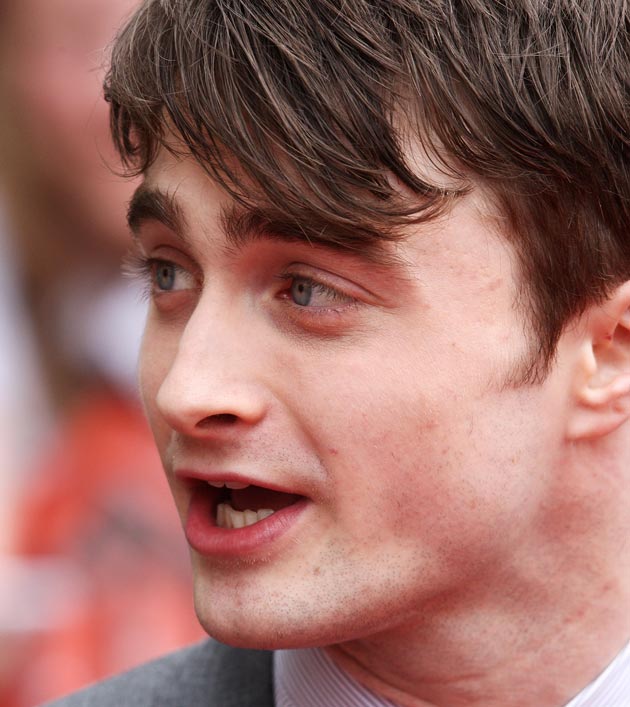 Celestial to fleshy: 14 kinds of noses, find yours! - Photogallery