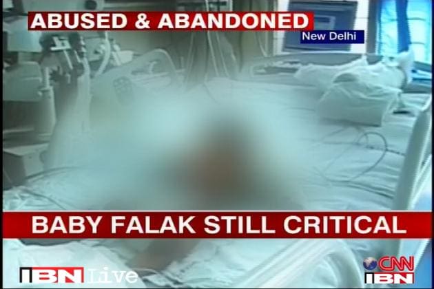 Delhi: Baby Falak continues to battle for life - News18