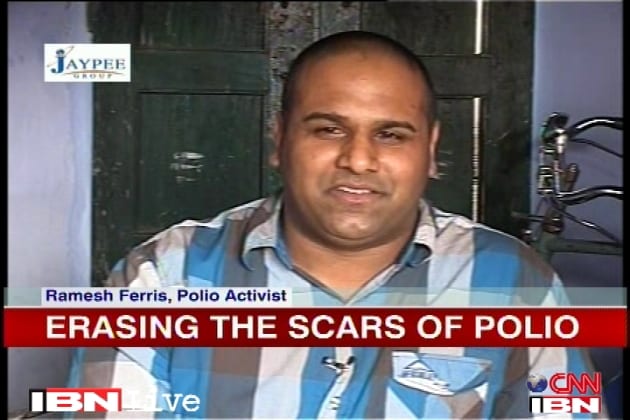 Polio-stricken man returns to from Canada to spread awareness - News18