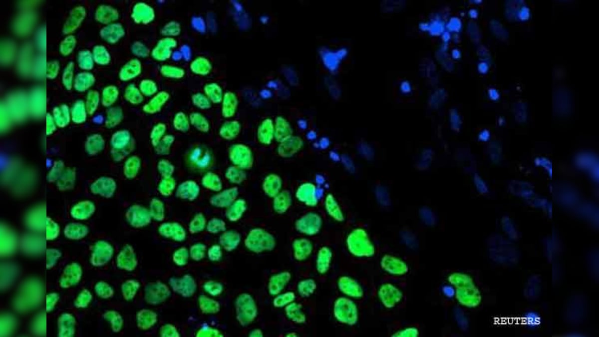 Scientists finally create human stem cells through cloning - News18