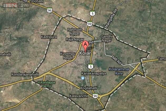 Karnataka: MBBS student battling for life after being set on fire - News18