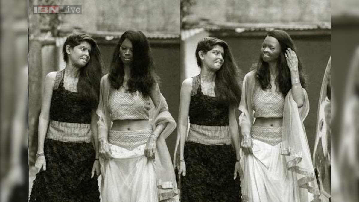 Photos: Five acid attack victims took part in an inspirational ...