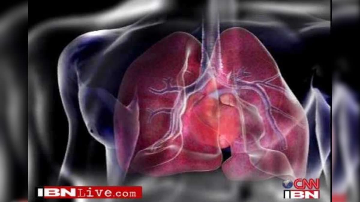 Battery less cardiac pacemaker powered by heart - News18