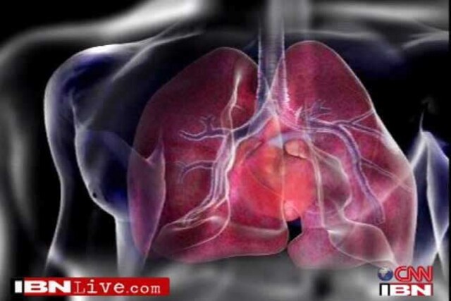 'Dead' hearts transplanted into living patients in world first - News18