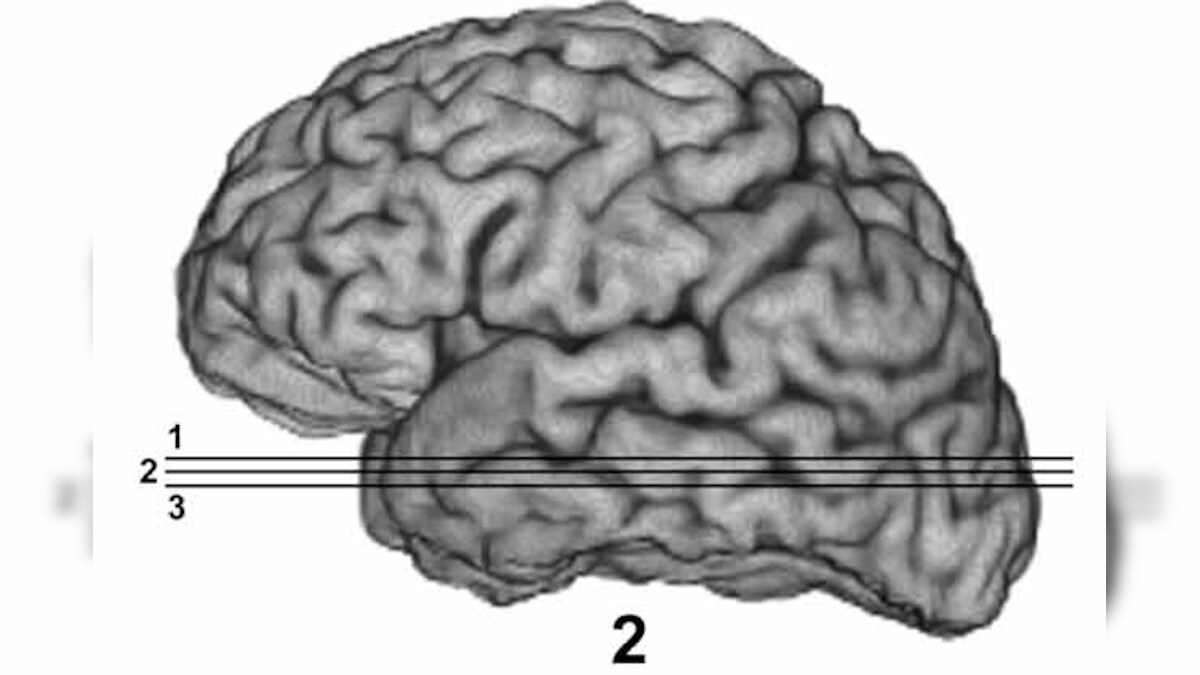 Multitasking may damage your brain: Study - News18