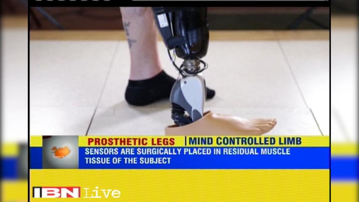 New sensors allow people to control limbs with their minds in Iceland ...