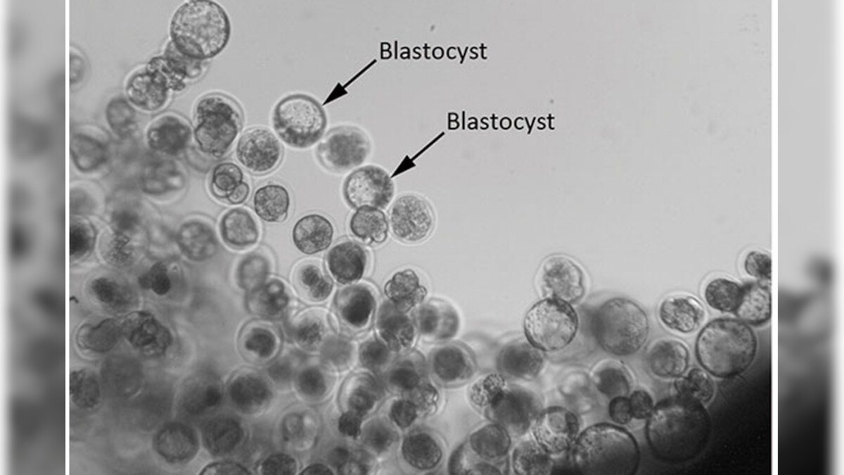 In a First, Scientists Develop Mammal Embryos in Space - News18